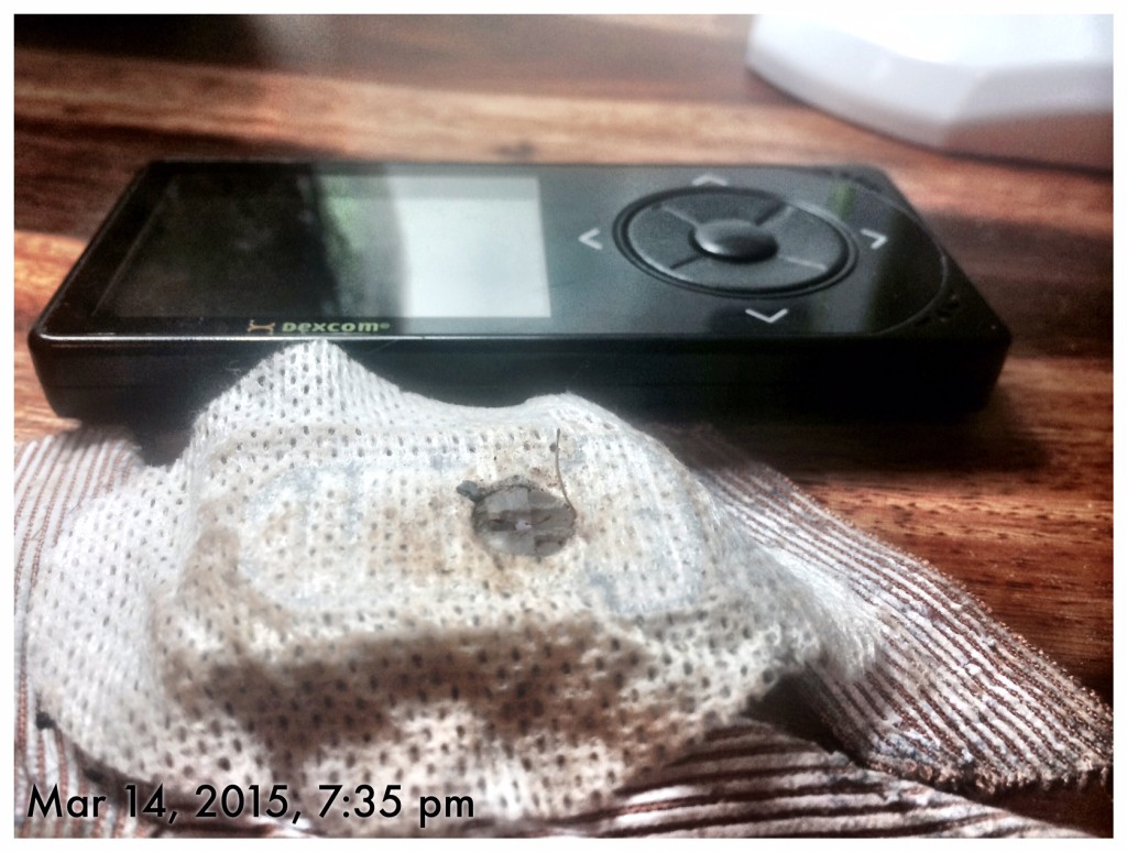 Healthy Eating & Experience of using Continuous Glucose Monitoring ...